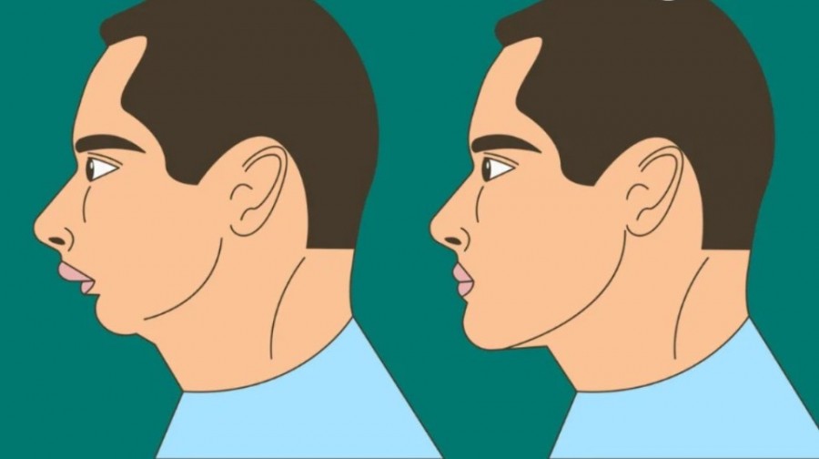 Mewing Nedir? Mewing nasıl yapılır? - Yaşam Haberleri - Bursadabugun.com