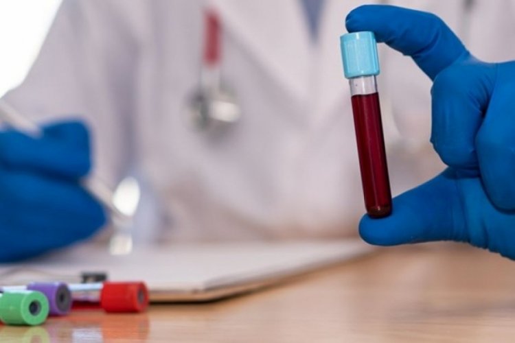 Kanseri tespit eden kan testi - Sağlık ve Beslenme Haberleri ...